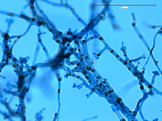 Fun With Microbiology (What's Buggin' You?): Fonsecaea pedrosoi/monophora