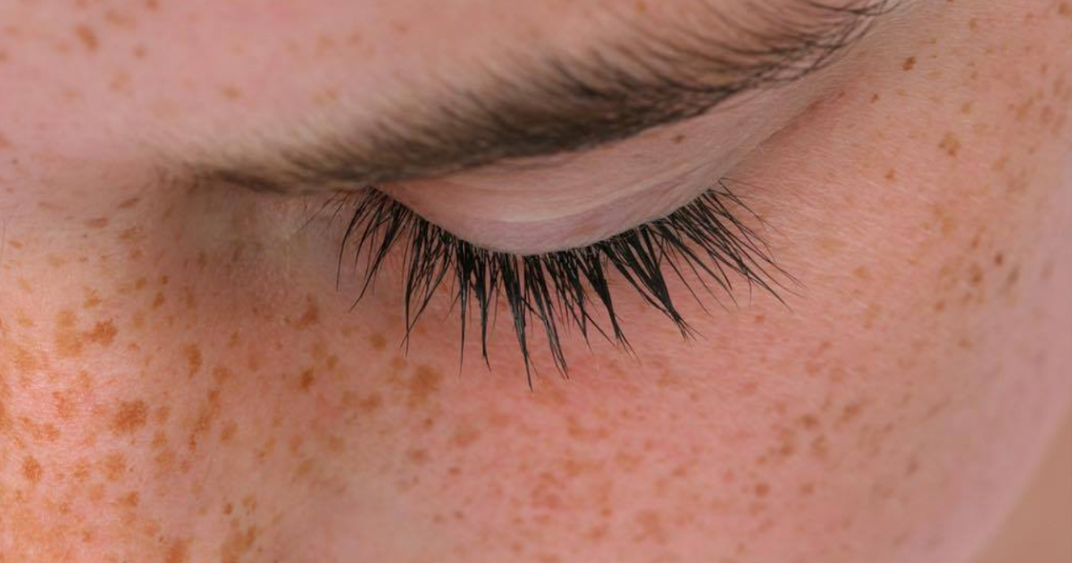 7 Cara Hilangkan Jeragat Di Muka Yang Berkesan. Cubalah!