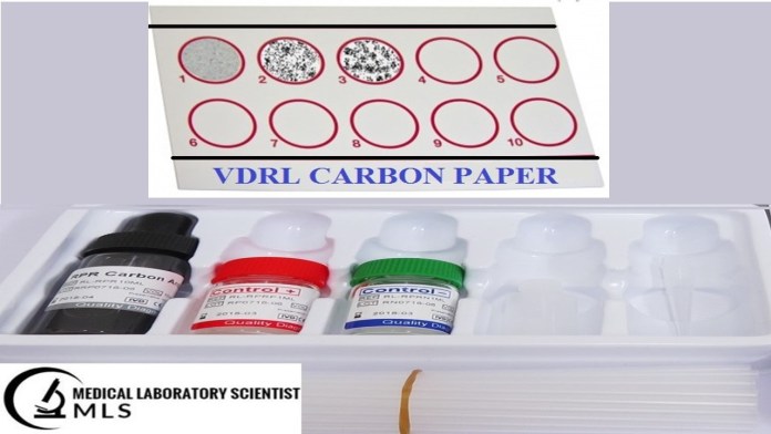 Ciencias de la Salud: VDRL - Laboratorio de Investigación de ...