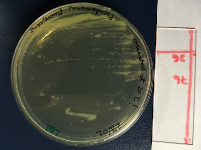 Learning Thru Research: Get to know Pseudomonas fluorescens