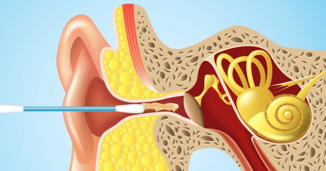 What Really Happens When You Put A Q Tip In Your Ear Handy Diy