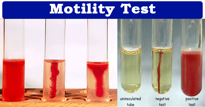 Ram Micro Arena : MOTILITY DETERMINATION- SOFT AGAR METHOD