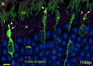 Review of Optology: Ocular Effects of Prion Disease