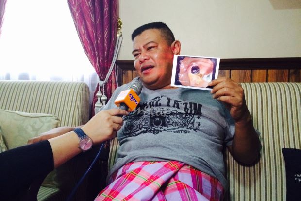 Azlee (Senario) Takut Jalani Pembedahan Kedua Buang Hempedu | Berita ...