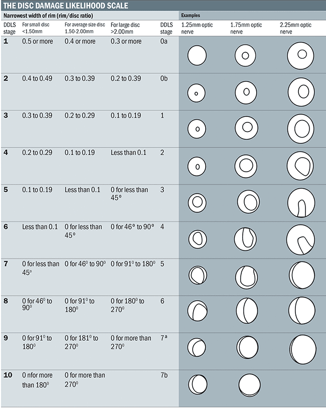 Ophthalmology Notes: Disc Damage Likelihood Scale (DDLS)