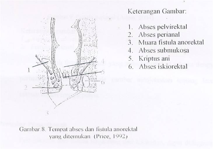 RADIOGRAFER WORLD: FistulogrAfi