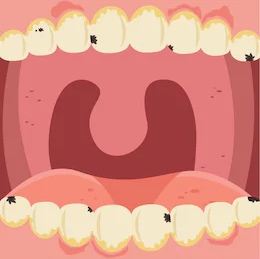 CLASIFICACIÓN DE LOS CÁLCULOS DENTALES