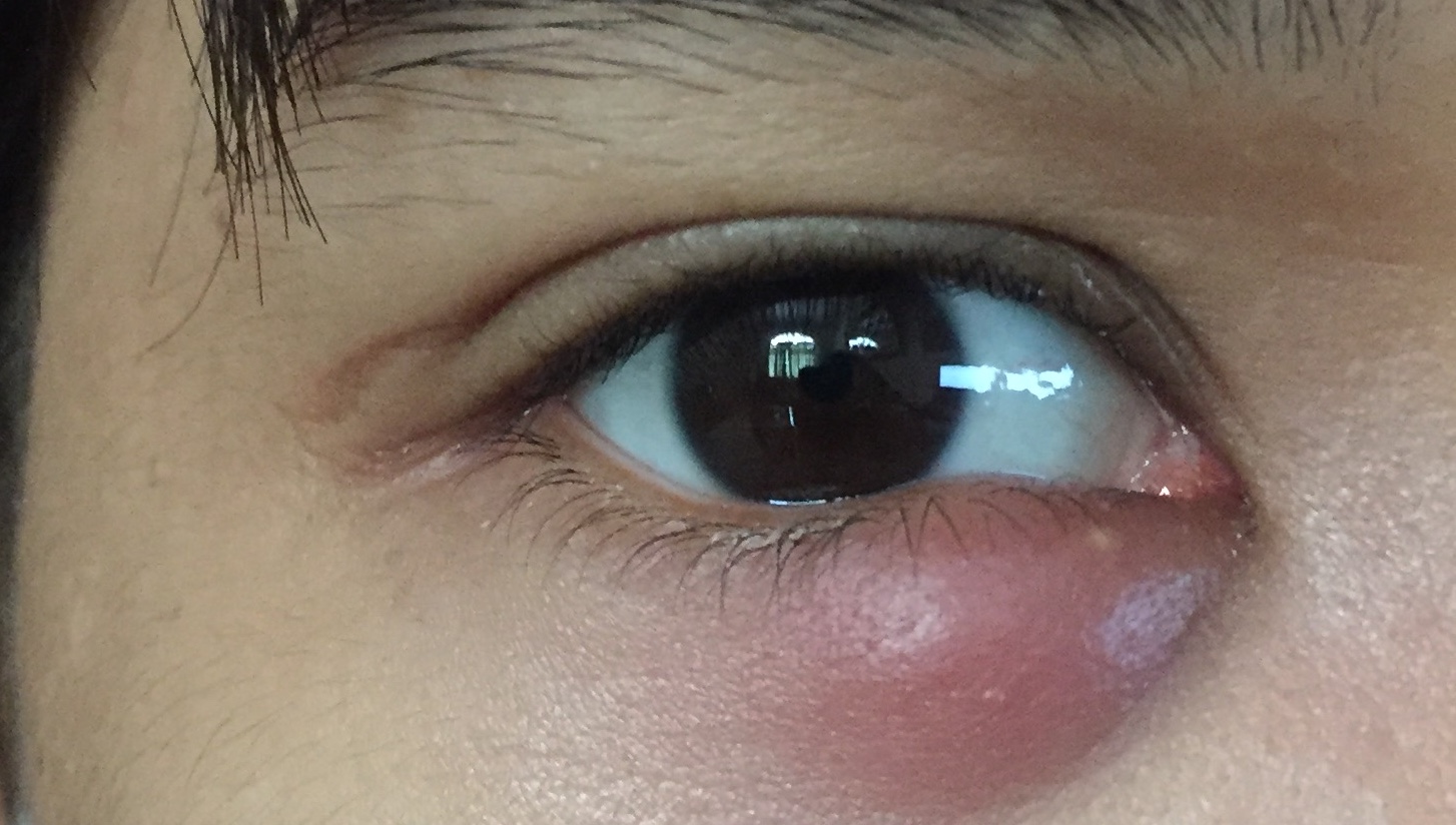 Dropped like a Hatputito: Worst Stye as Yet!