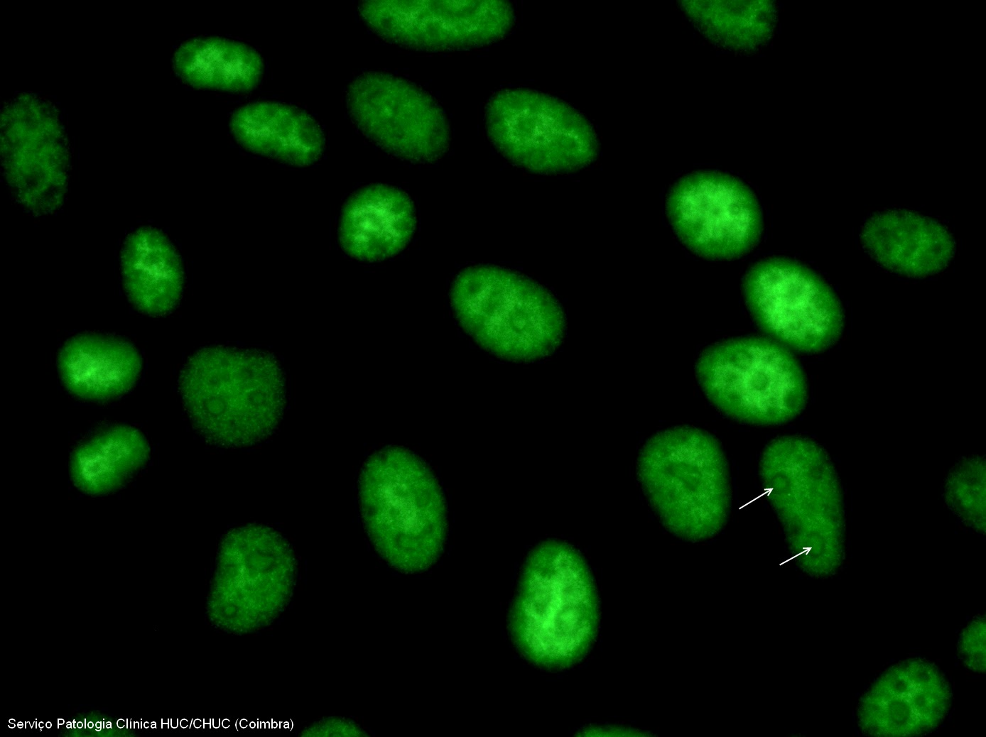 Ssa Ro Reagente O Que Significa - RETOEDU