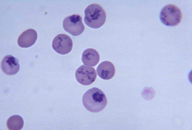 Fichero de Hematologia: Reticulocito