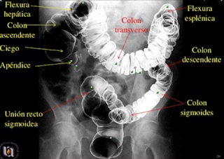 PROTOCOLO DE ESTUDIOS ESPECIALES: TRÁNSITO INTESTINAL