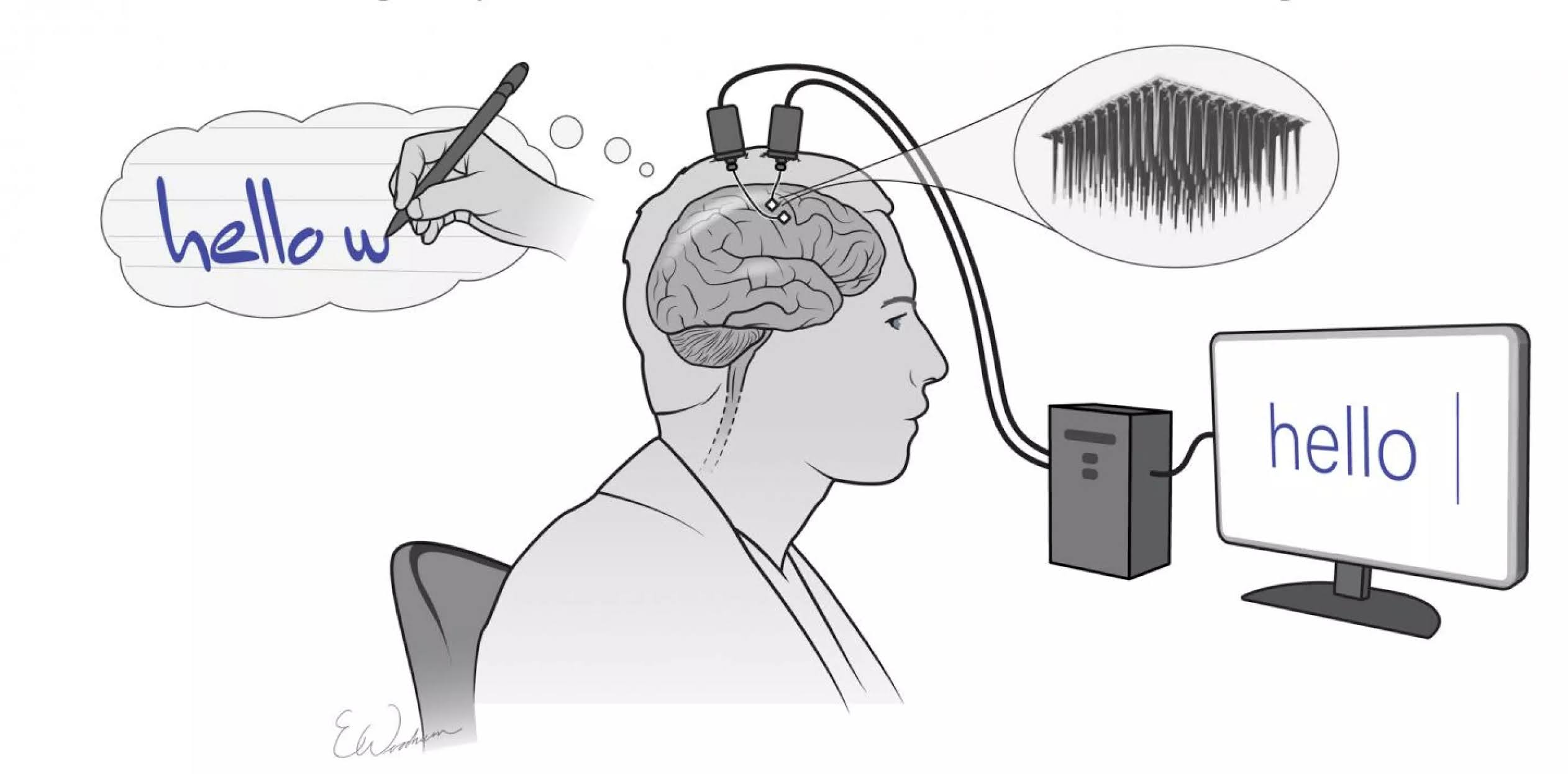 가장 빠른 타이핑이 가능한 뇌-컴퓨터 인터페이스 (BCI)