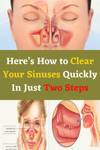 Here’s How to Clear Your Sinuses Quickly In Just Two Steps
