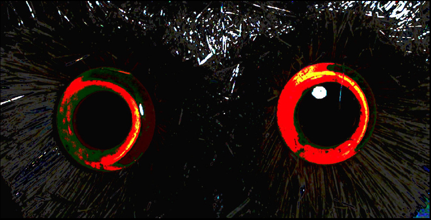 PTED Post-Traumatic Embitterment Disorder