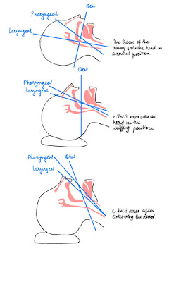 Medicowesome: Endotracheal intubation