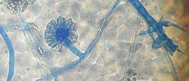 ATLAS MICOLOGIA: SYNCEPHALASTRUM RACEMOSUM