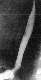 Notícias RX: Imagens