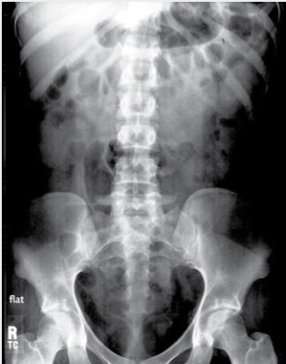 DICAS DE RADIOLOGIA - Tudo Sobre Radiologia: POSICIONAMENTO DO RAIO X ...