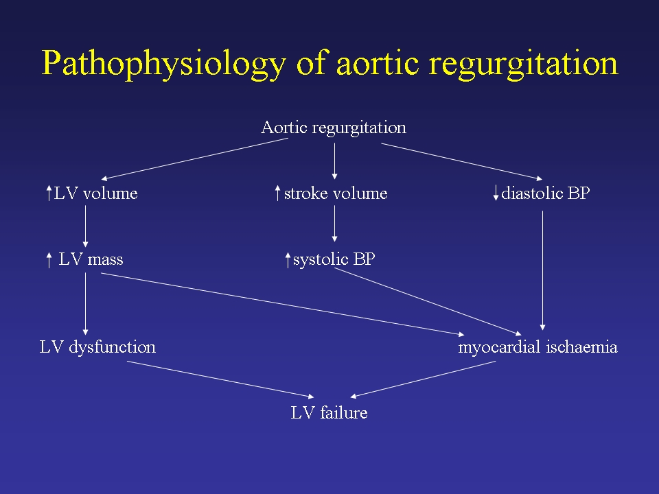 Medical Lecture Notes Online Valvular Heart Disease Medical Lecture Notes Online Valvular Heart Disease