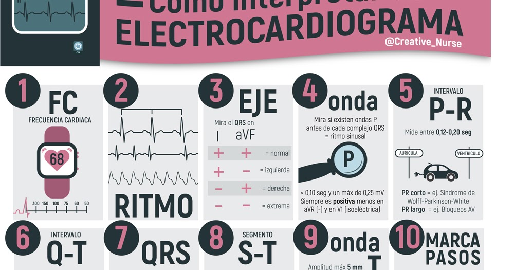ZONA DE SALUD DE OFRA: Chuletas Médicas. 10 sencillos pasos para interpretar un Electrocardiograma