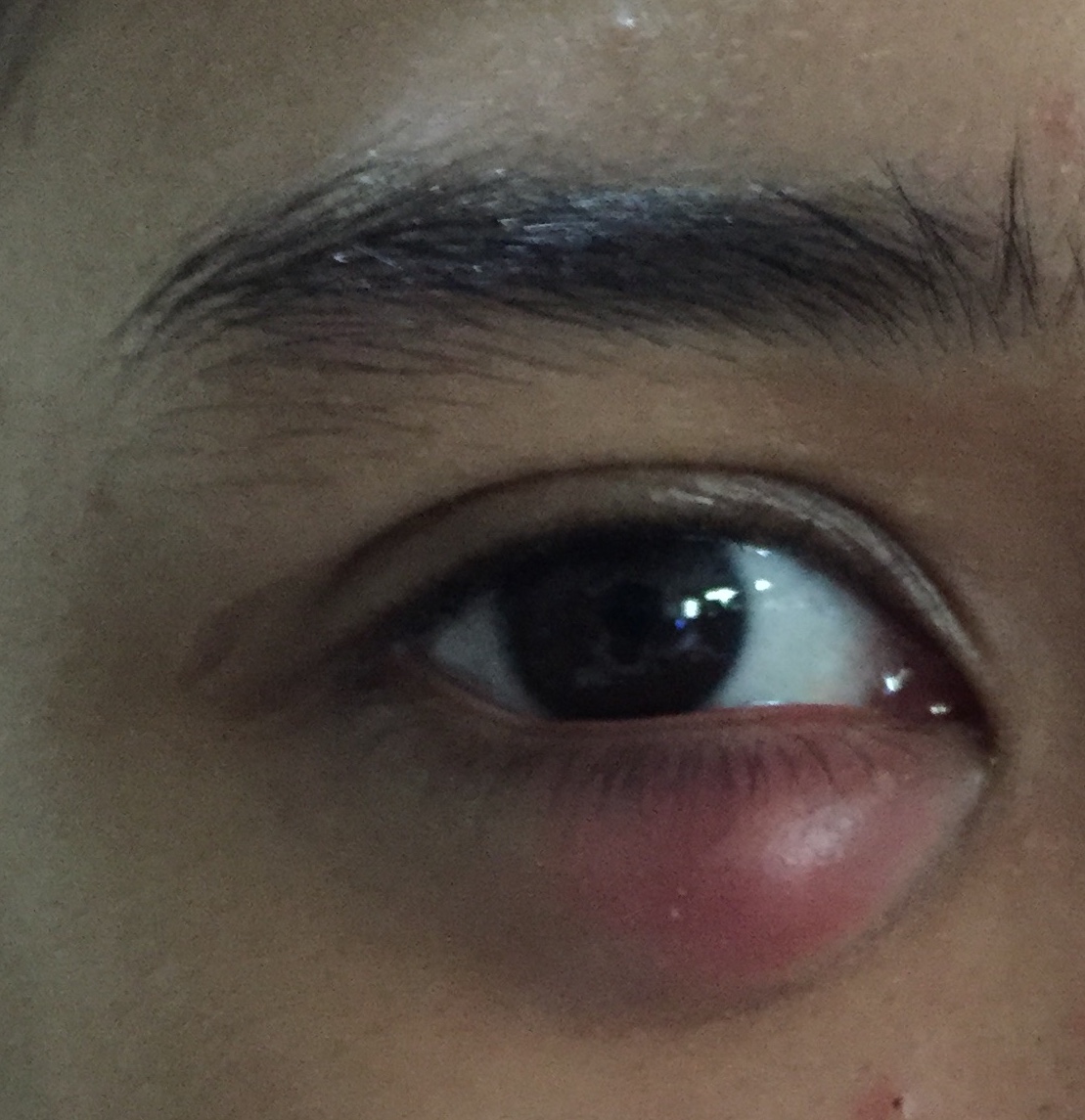 Dropped like a Hatputito: Worst Stye as Yet!