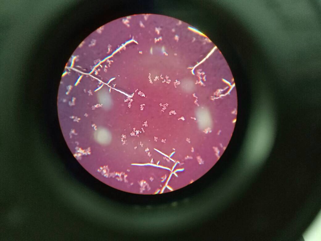 Experiment 6: Preparation of bacterial smear, Experiment 7: Simple ...