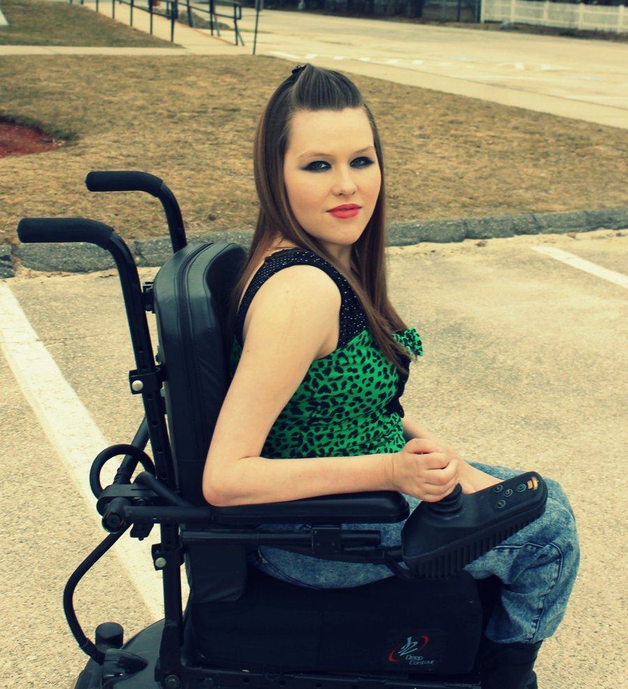 Amputee Beautiful Women Shes Quite Beautiful Amputee Girls