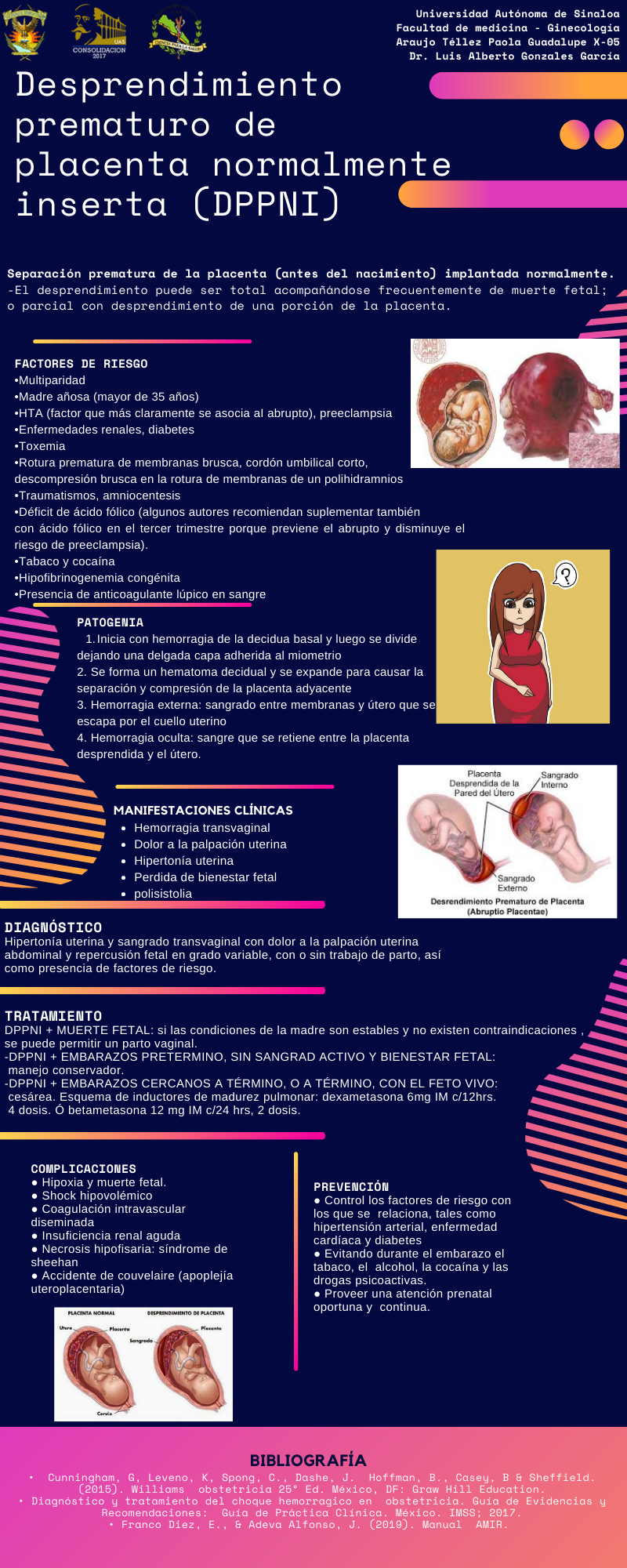 Desprendimiento Prematuro de Placenta Normalmente Inserta (DPPNI)