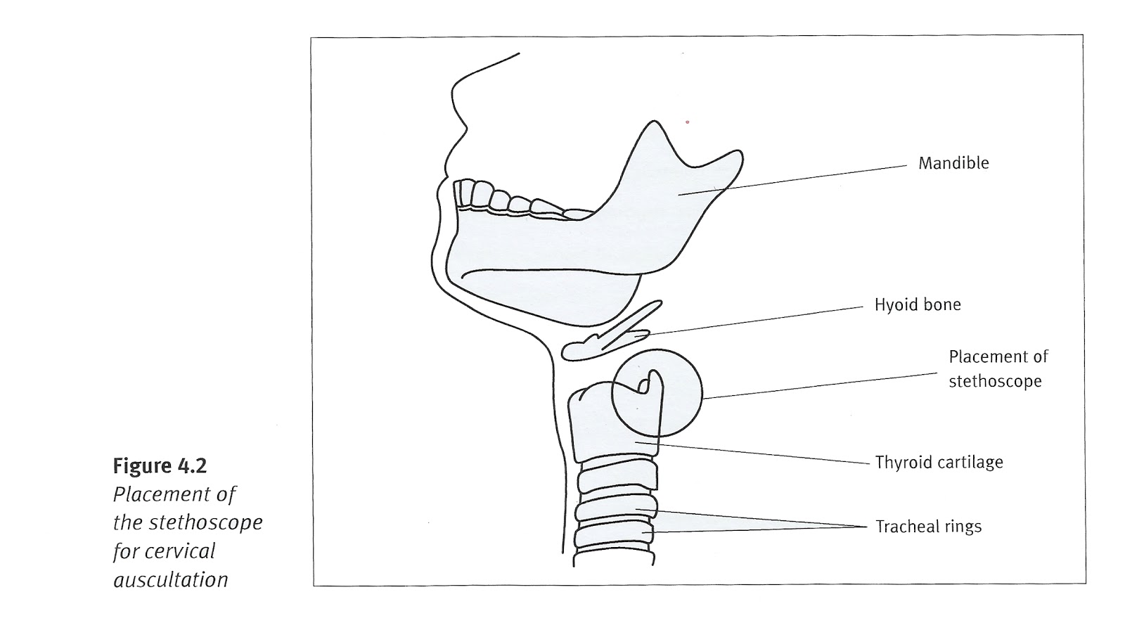 Brain Salt: Cervical Auscultation