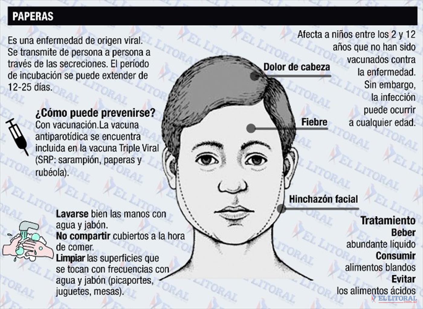CSIF CC&CC: PREVENCIÓN PAPERAS
