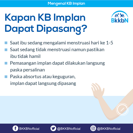 √ Pengalaman Pasang dan Lepas Kontrasepsi KB Implan - Duduk Paling Depan