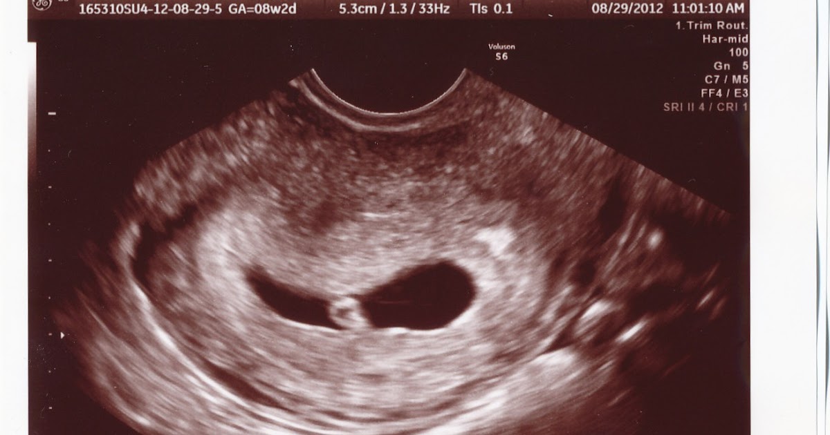 Svensson Baby Bump: 6 weeks and counting...