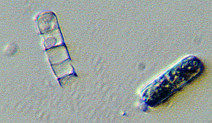 Don Schaeffer's Photos and Art: Green Algae from Tyler's Vase (length ...