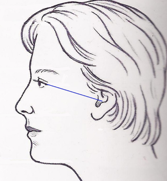 Estudo Radiográfico : PLANOS, MARCOS TOPOGRÁFICOS E LINHAS DO CRÂNIO