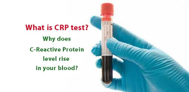 What is CRP test? - health and medical tips in Multan