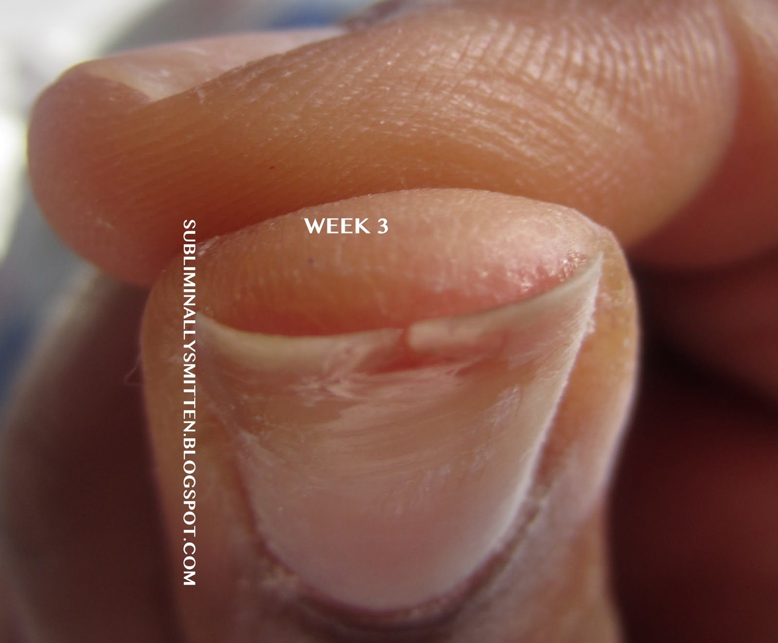 ~~~SubliminallySmitten~~~ : Healthy Nails: The Journey