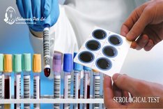 Serology ~ Lab Tests Guide