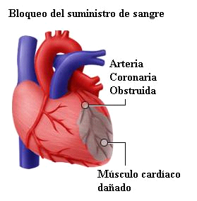 Como sobrevivir a un paro cardiaco infarto o ataque al corazon cuando ...