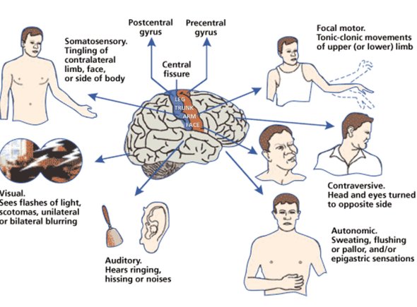 Causes Of Unresponsiveness In Adults - forestmake
