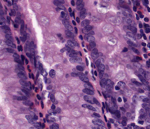 MoyinAdesanyaBiol 3500: The Human Appendix: My Favorite Organ: The ...