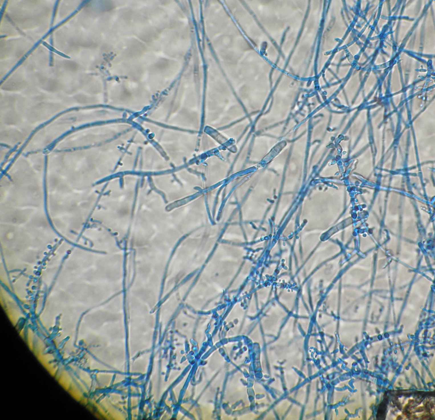 ATLAS MICOLOGIA: TRICHOPHYTON INTERDIGITALE