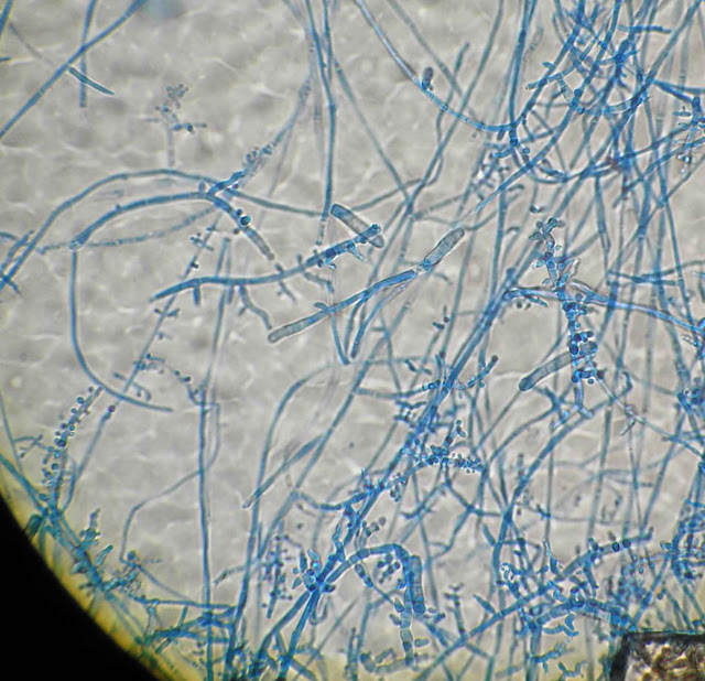 ATLAS MICOLOGIA: TRICHOPHYTON INTERDIGITALE