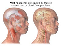 Health Care: Headache