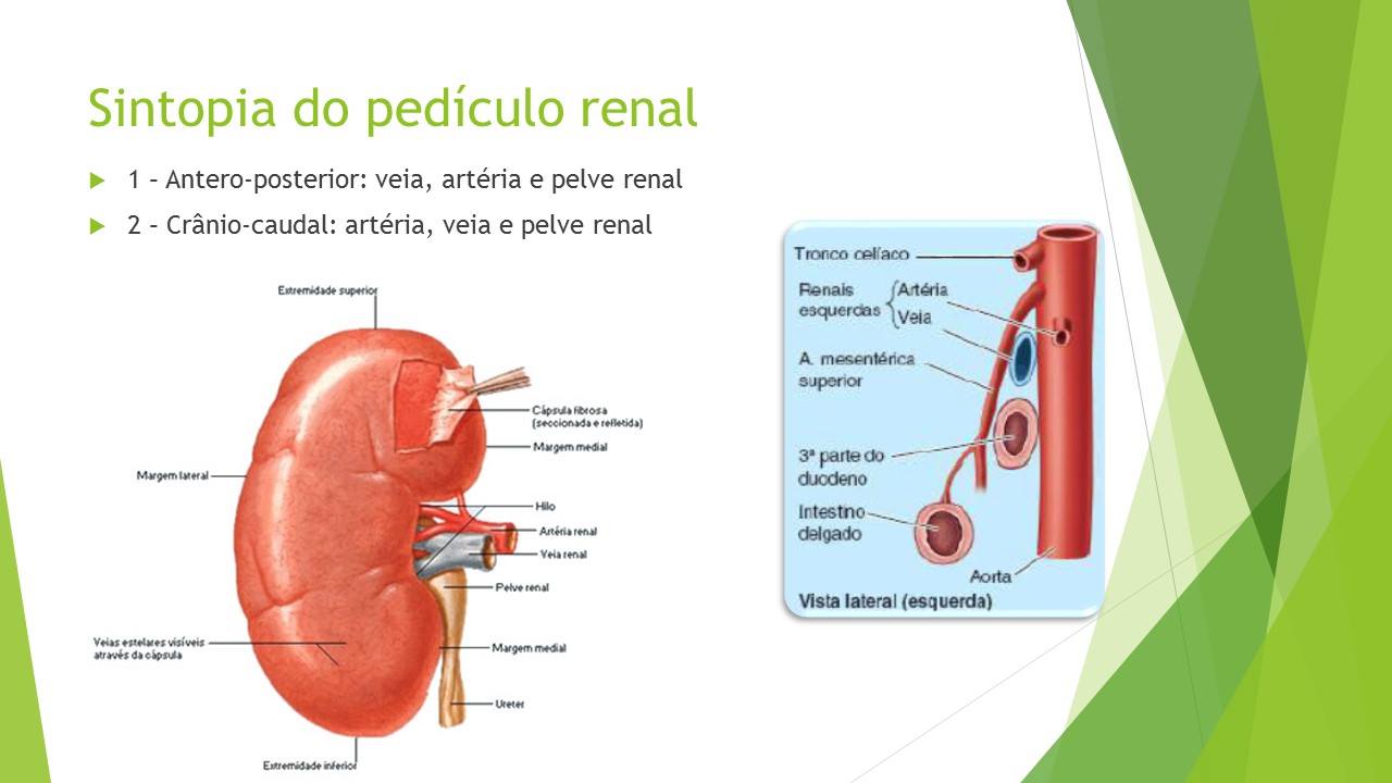 Liga de Anatomia ULBRA: RINS E NEFROLITÍASE