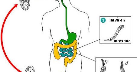 Citología Exfoliativa Mérida: Enterobius vermicularis (Oxiuros) en ...