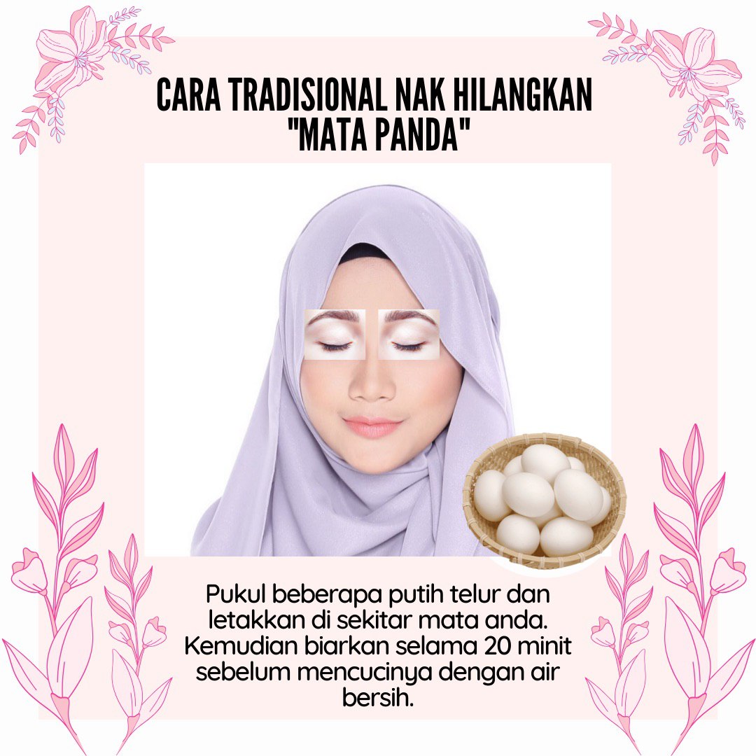 7 Cara Mudah Hilangkan Mata Panda Atau Mata Lebam