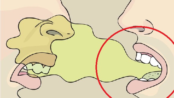 ¿Por qué se produce el mal aliento y cómo lo elimino?