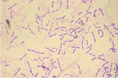 [Microbiology] Atlas of Haemophilus and Other Fastidious Gram-Negative ...