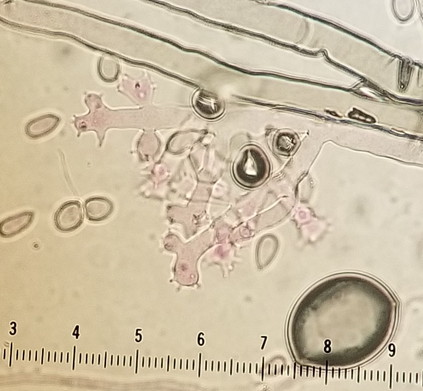 Sustainable Mycology: More blueberry Botrytis