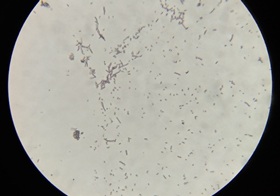 LAPORAN PRAKTIKUM MIKROBIOLOGI ALT: UJI CEMARAN MIKROBA METODE ANGKA ...